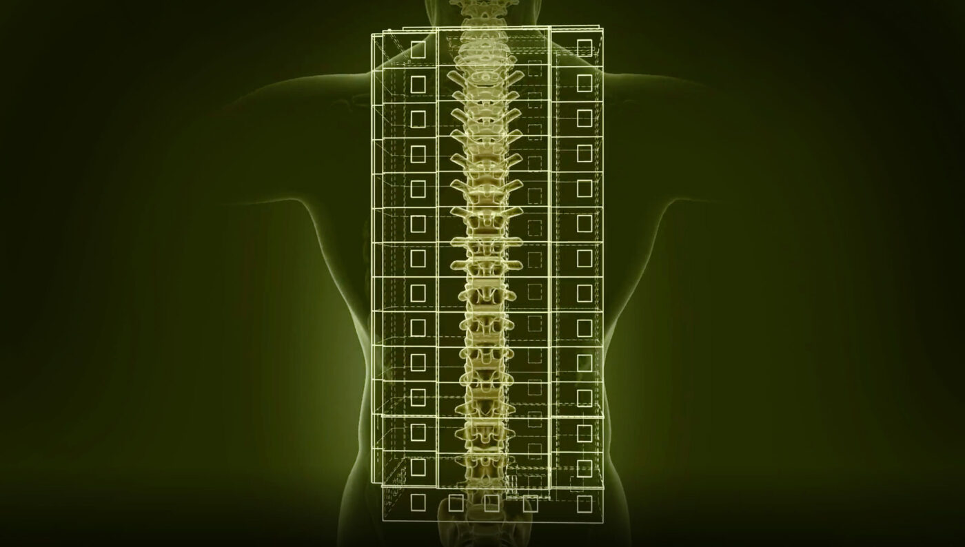 Green Spine Line® - Strängbetong